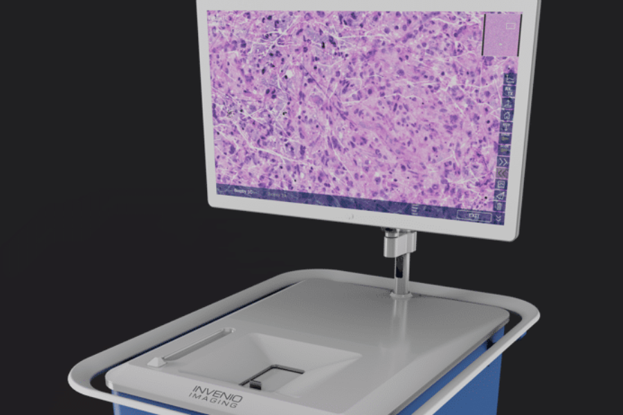 ICT Business | AI Will Analyze Cancer Cells in the Operating Room